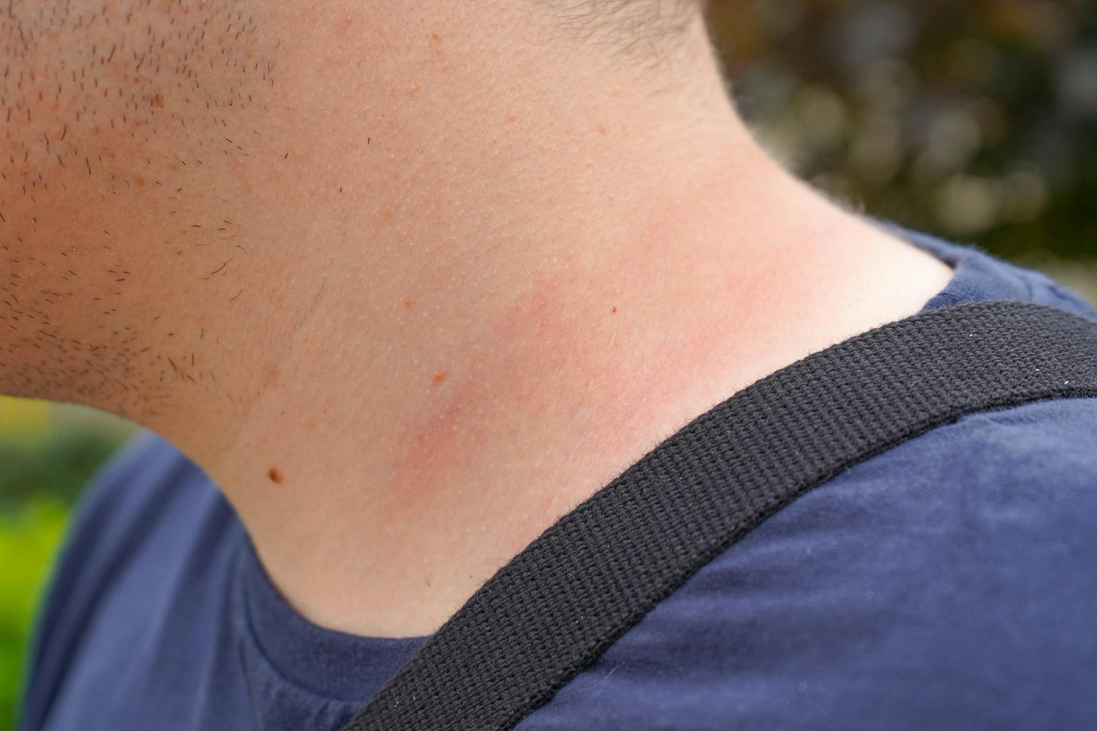 Trakke Banana Crossbody Bag Review | Pack Hacker